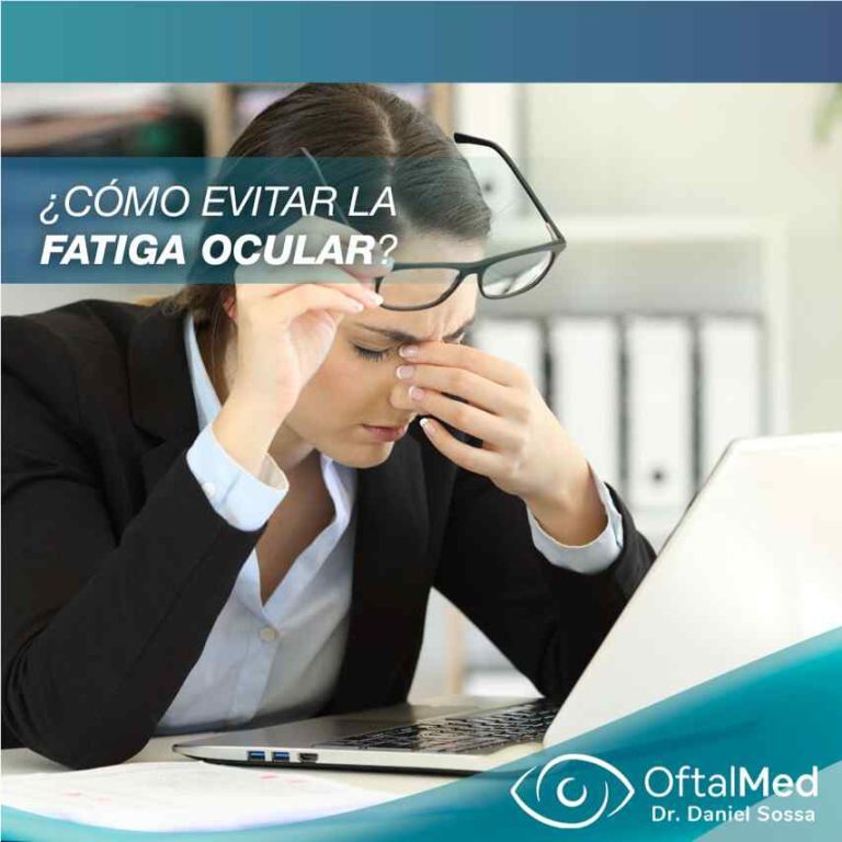 Como Evitar La Fatiga Ocular - Dr. Daniel Sossa Mendez - Cirujano Oftalmólogo - Cochabamba