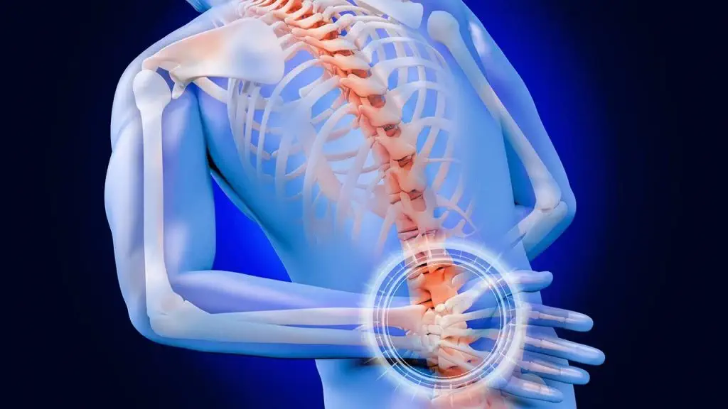 Dolor De Espalda - Hernia De Disco - Dr. Rodolfo Quiroga ...